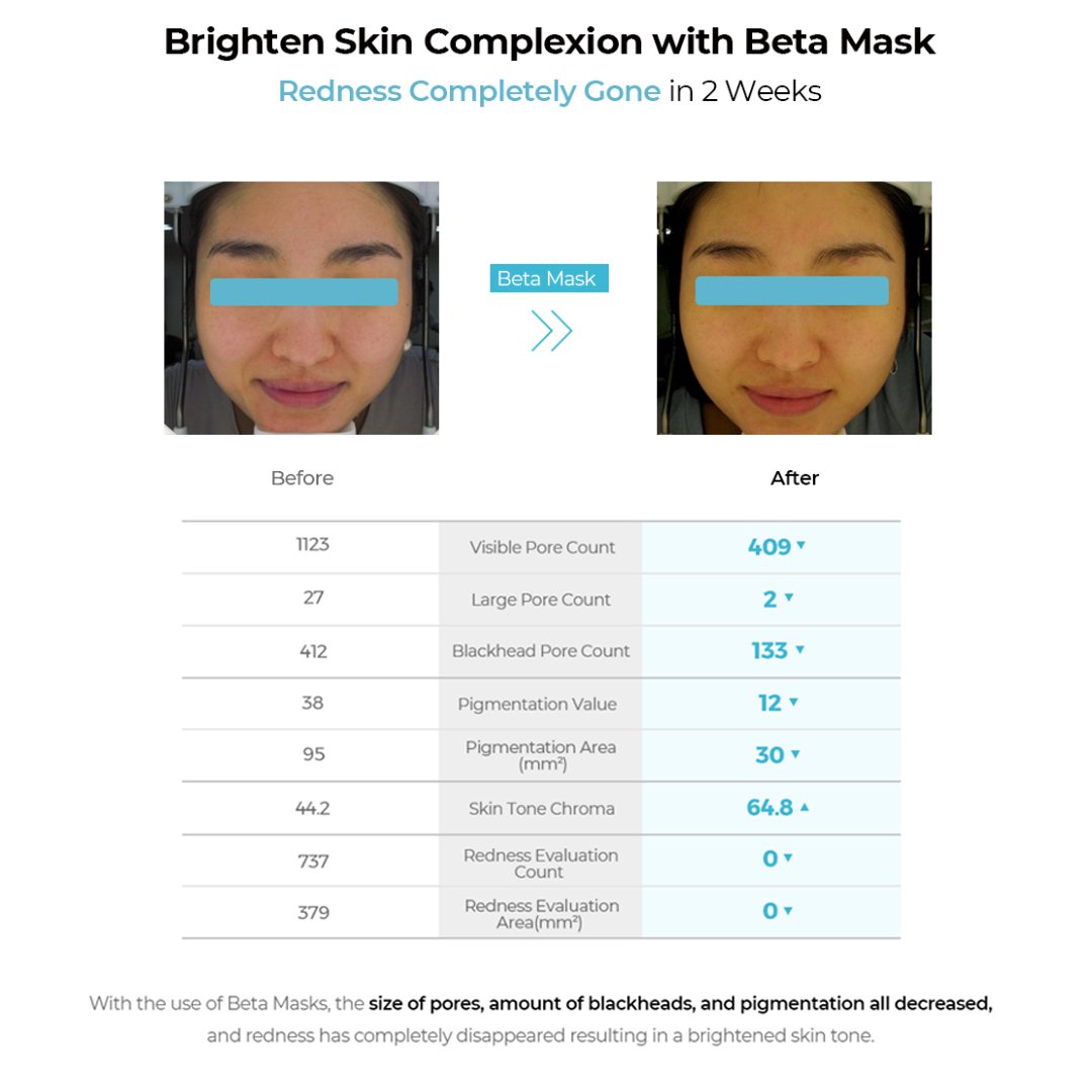 BETA MASK – Filler Hub